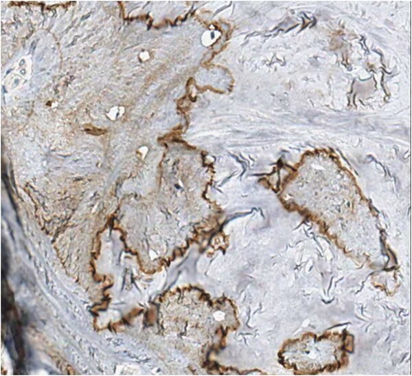 Anti-Osteocalcin Antibody, Clone 7D1.13 | MABD123